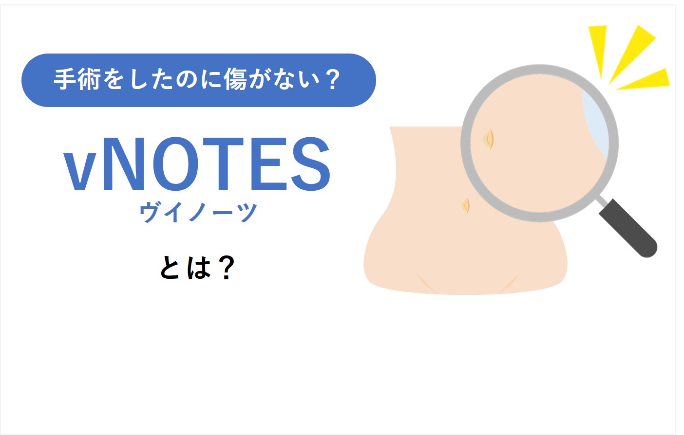 お腹を切らない婦人科腹腔鏡下手術 | 市立函館病院